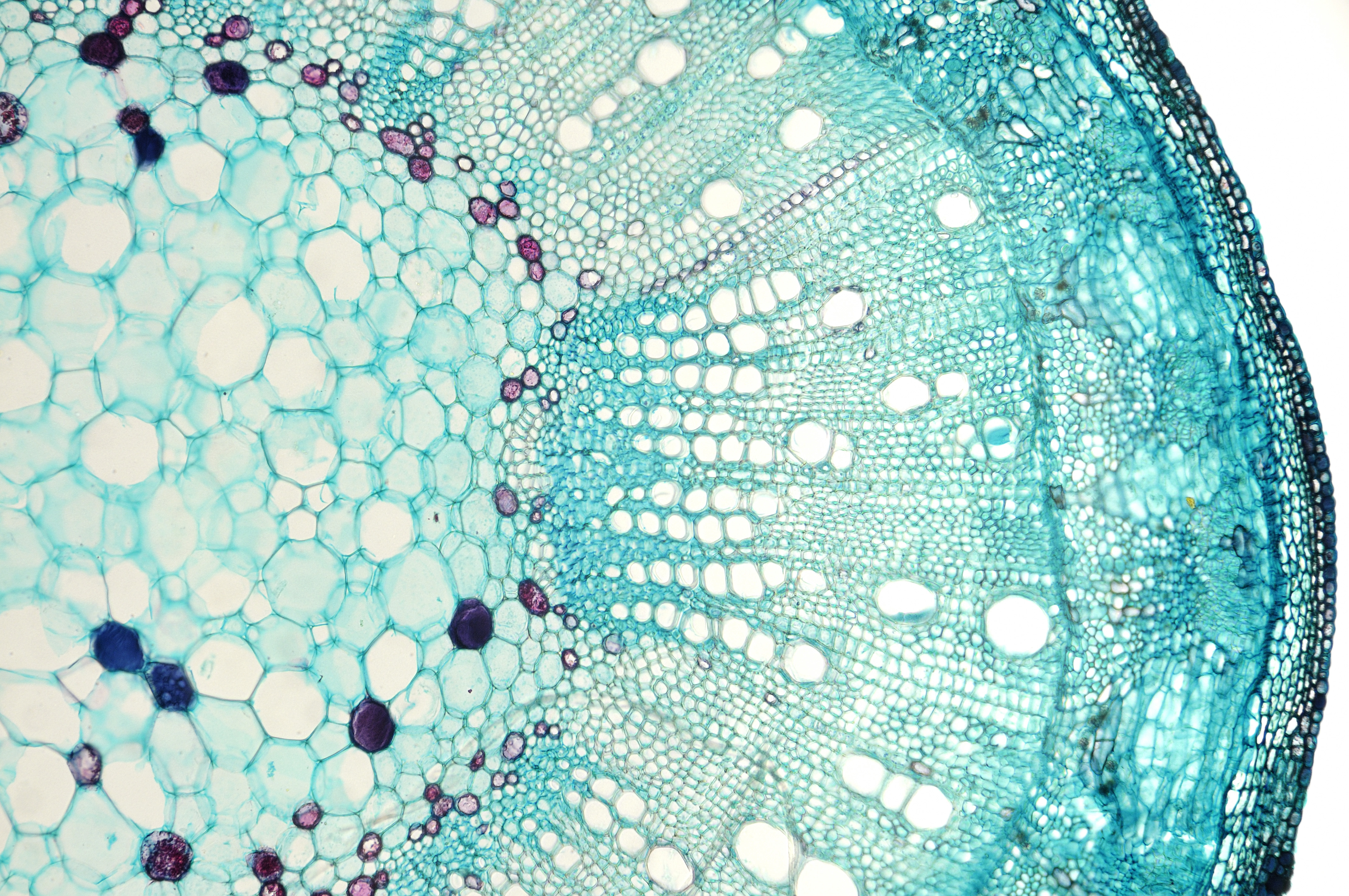 Research | PAINSTORM